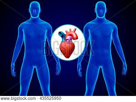 Human Heart Transplant Image & Photo (Free Trial) | Bigstock