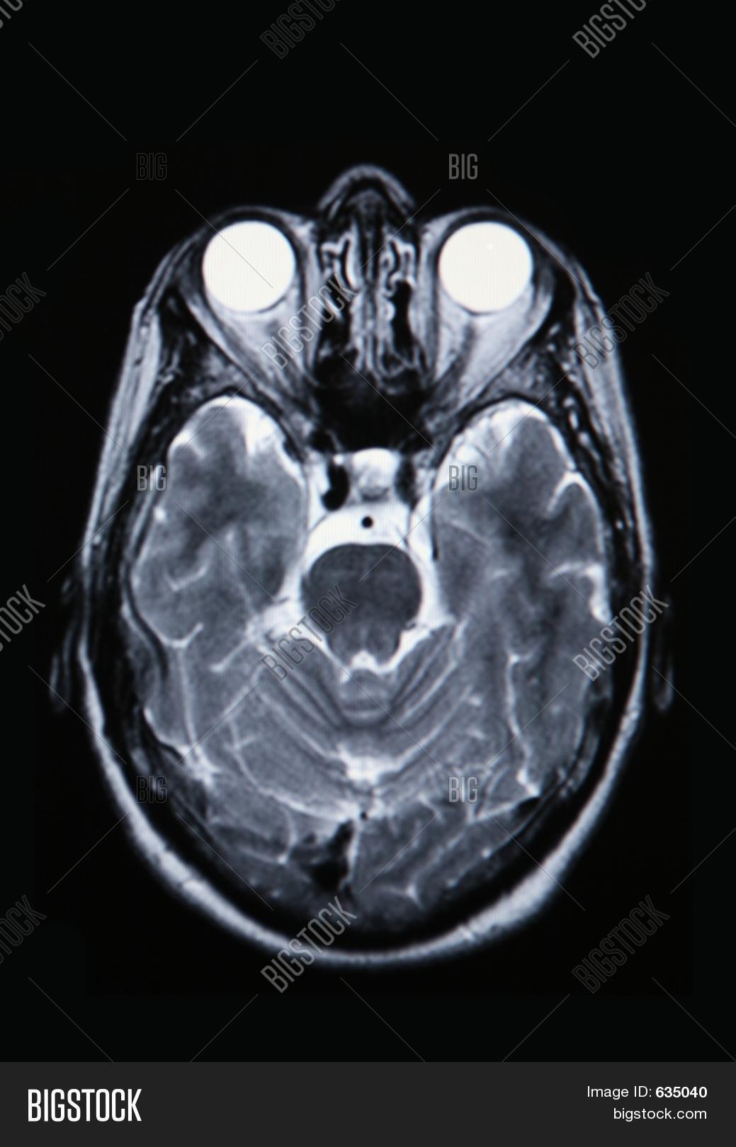 Real MRI/ MRA ( Image & Photo (Free Trial) | Bigstock