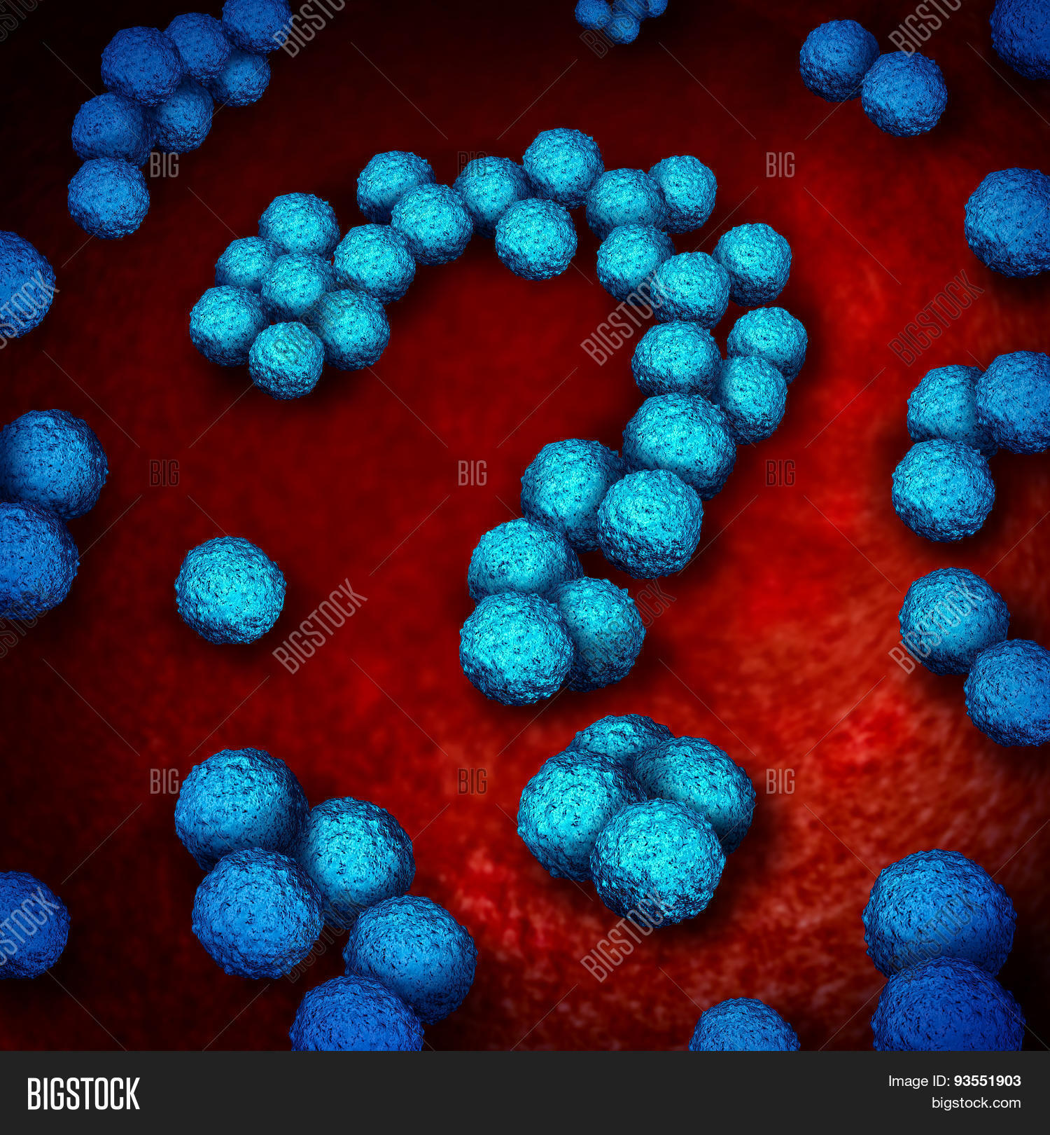 Superbug Infection Image & Photo (Free Trial) | Bigstock