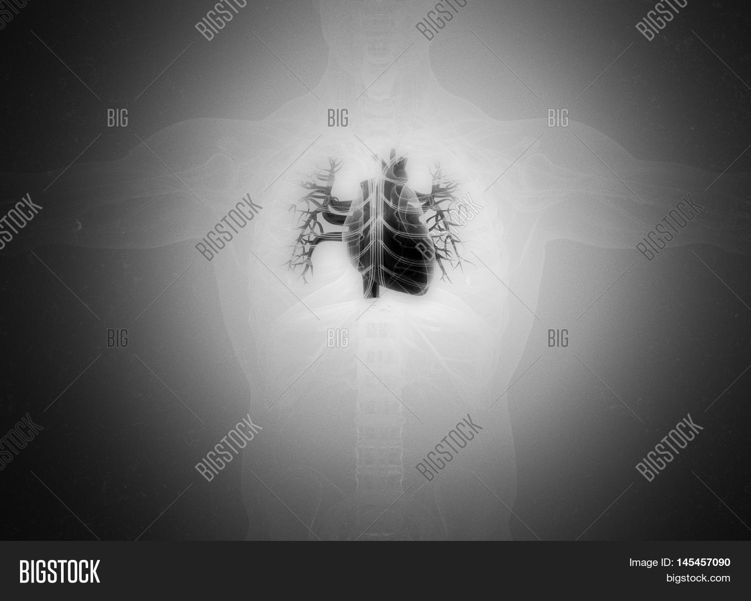 Human Heart. Rib Cage Image & Photo (Free Trial) | Bigstock