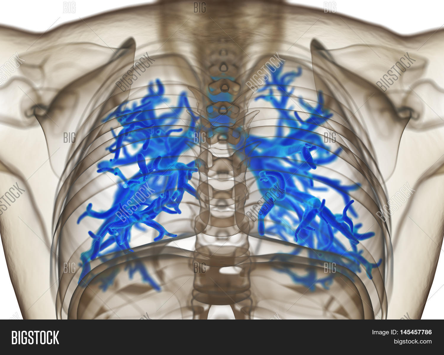 Imagen y foto Human Bronchi (prueba gratis) | Bigstock