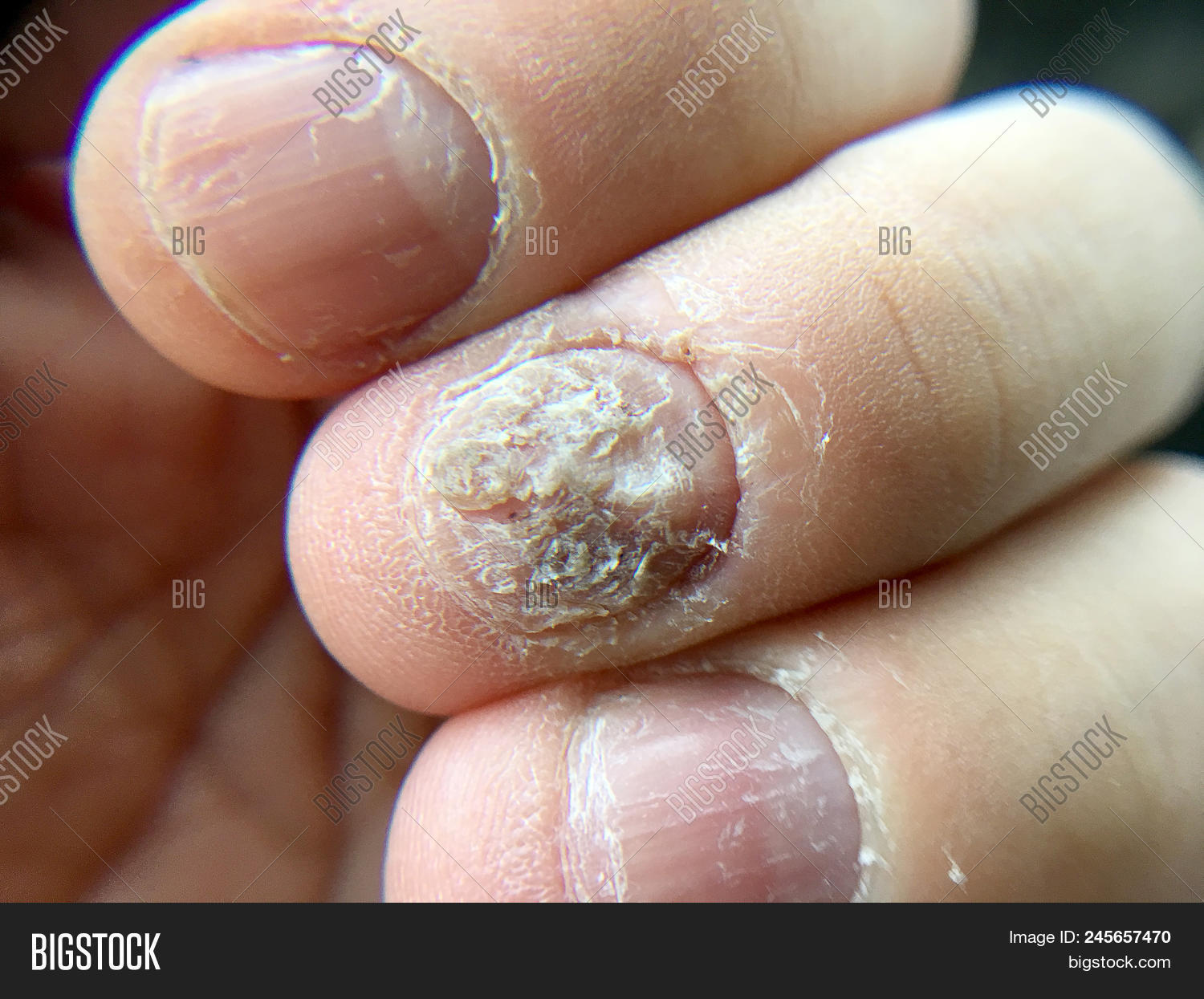 Big Close Fungus Image & Photo (Free Trial) | Bigstock