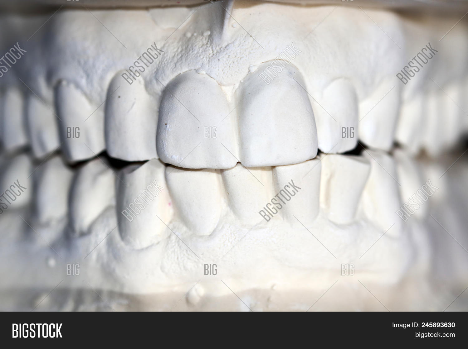 Model Plaster Cast Image & Photo (Free Trial) | Bigstock