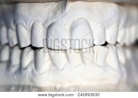 Model Plaster 图片和照片（免费试用） | Bigstock