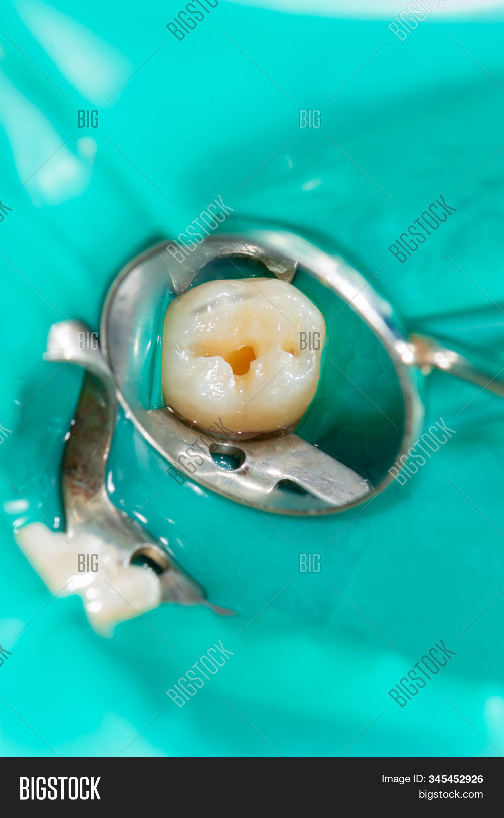 Two Chewing Side Teeth Image & Photo (Free Trial) | Bigstock