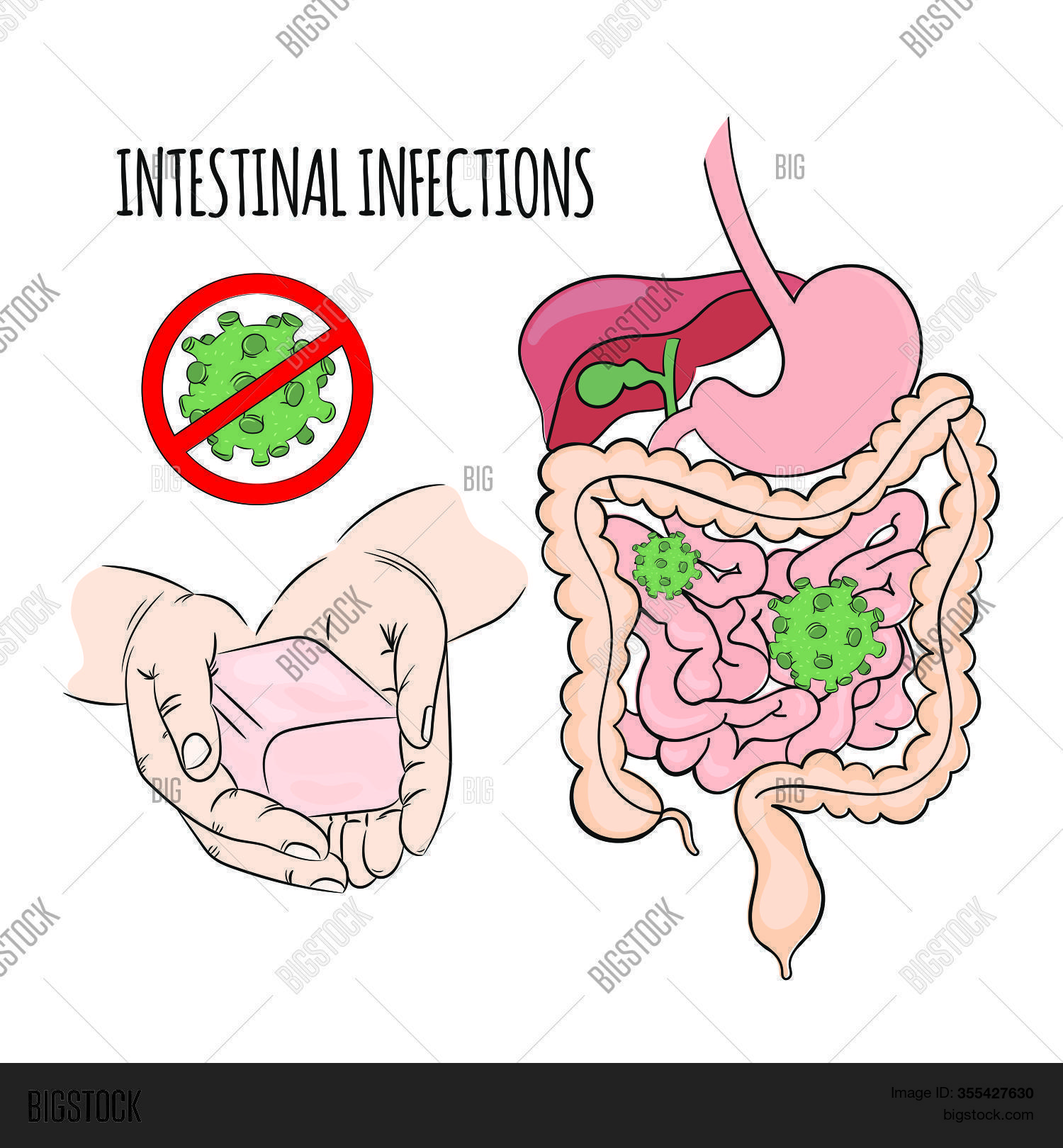 Intestinal Infections Vector & Photo (Free Trial) | Bigstock