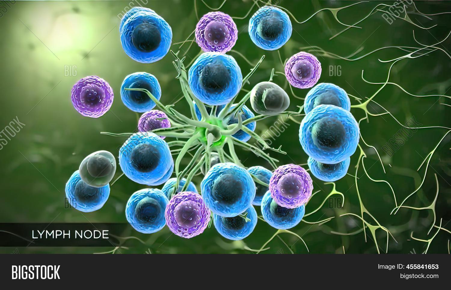 Lymph Node, Lymph Image & Photo (Free Trial) | Bigstock