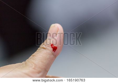 Closeup View Finger On Image & Photo (Free Trial) | Bigstock