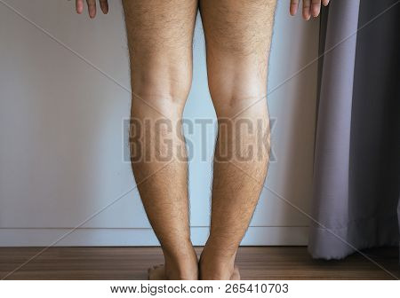 Asian Man Leg Bandy- Image & Photo (Free Trial) | Bigstock