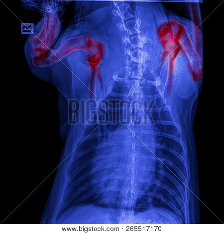 X-ray Dog Posterior Image & Photo (Free Trial) | Bigstock