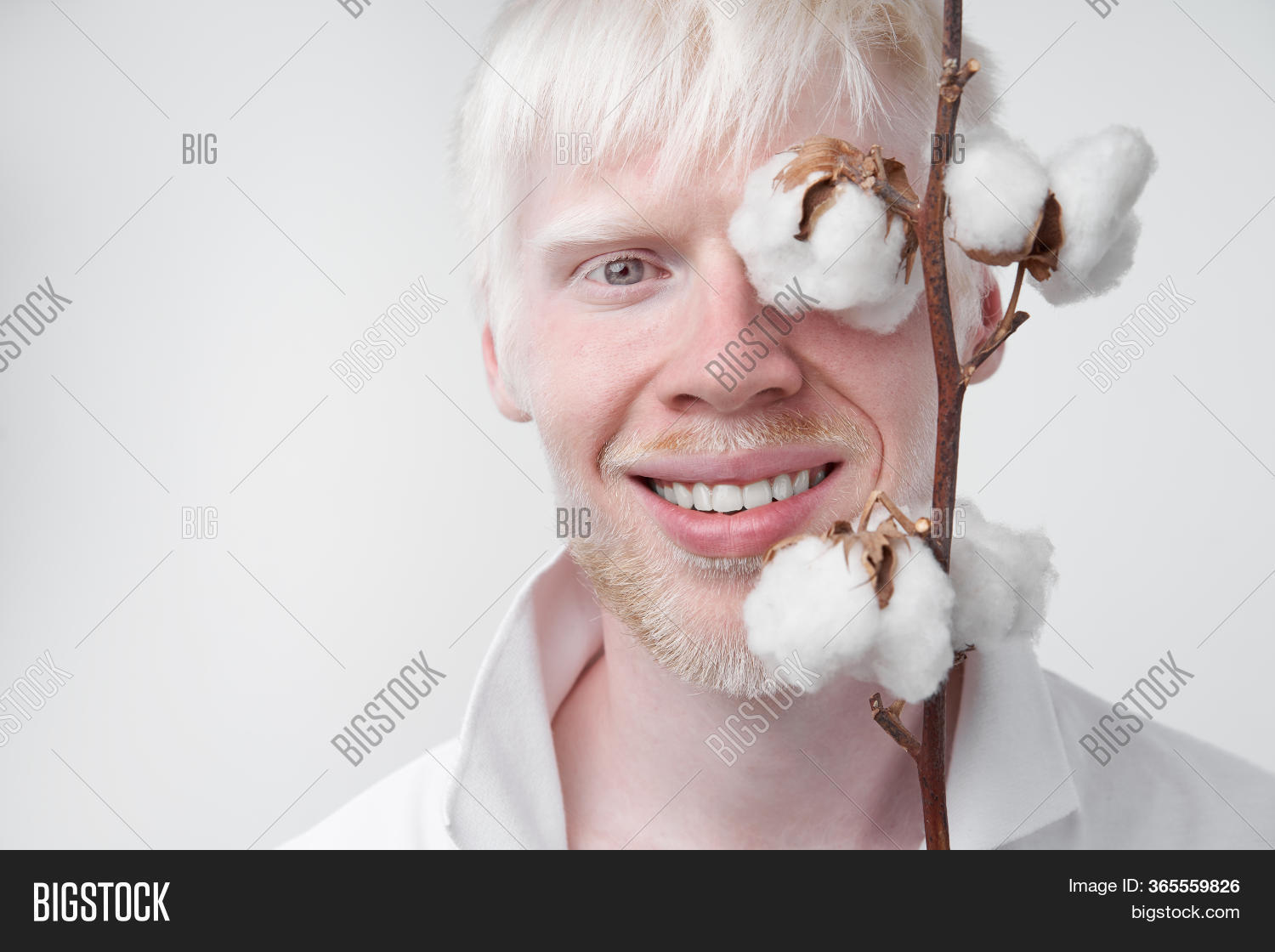 Happy Smile Albino Man Image & Photo (Free Trial) | Bigstock