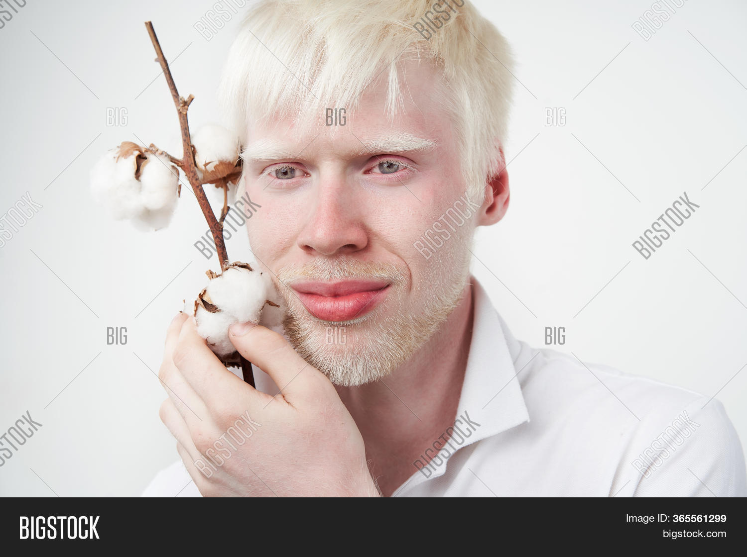 Happy Smile Albino Man Image & Photo (Free Trial) | Bigstock