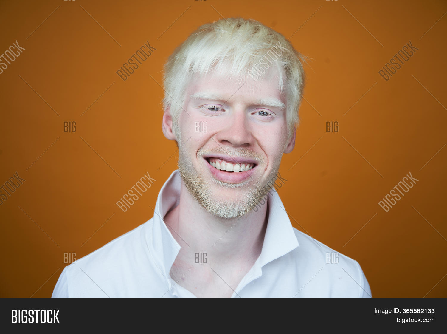 Happy Smiling Albino Image & Photo (Free Trial) | Bigstock
