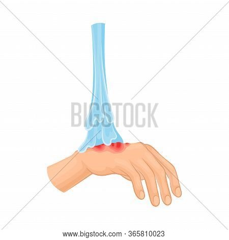 First Aid Hand Vector & Photo (Free Trial) | Bigstock