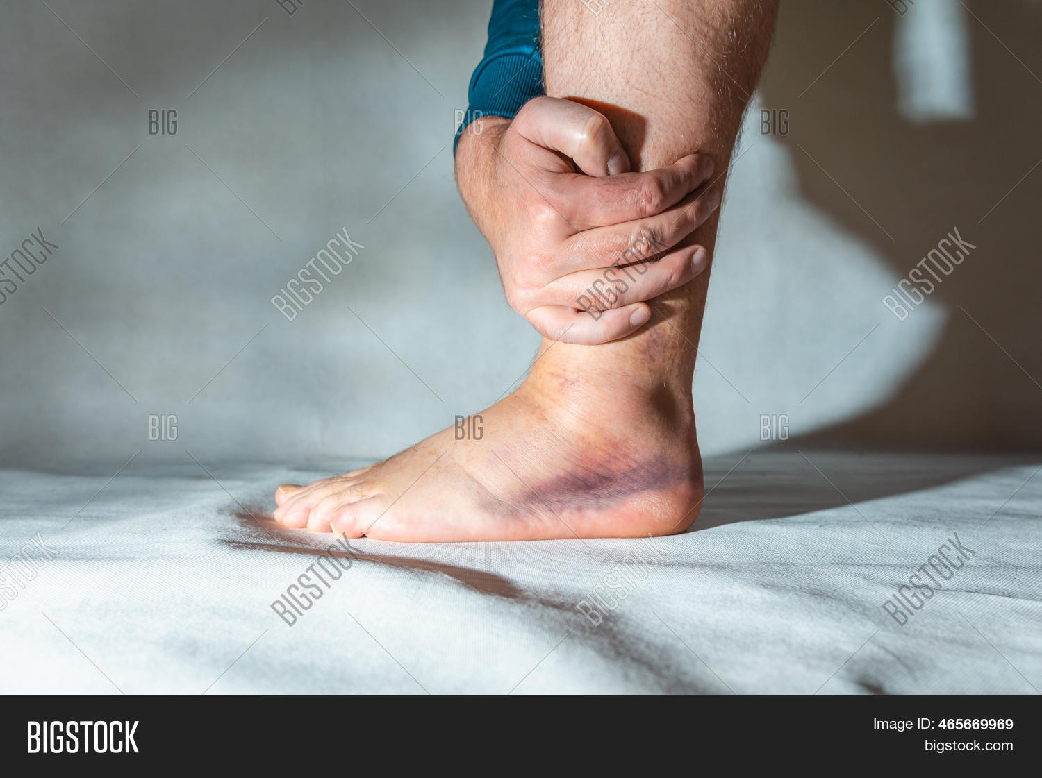 Sprained Swollen Ankle Image & Photo (Free Trial) | Bigstock