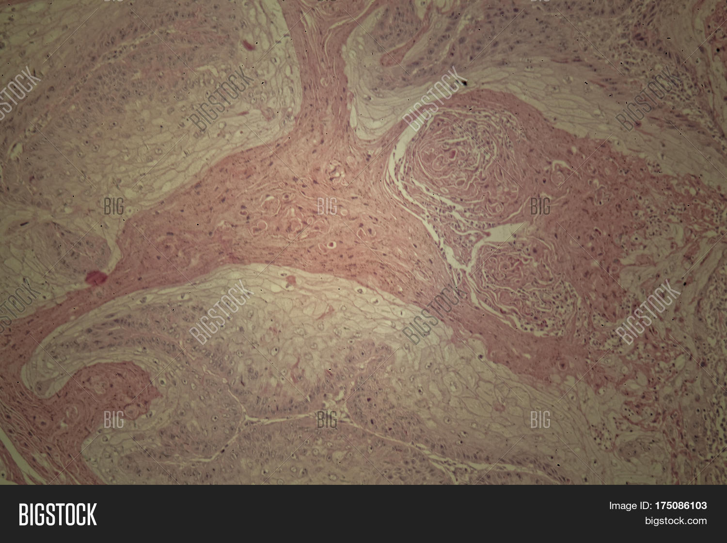 Cells Human Skin Image & Photo (Free Trial) | Bigstock