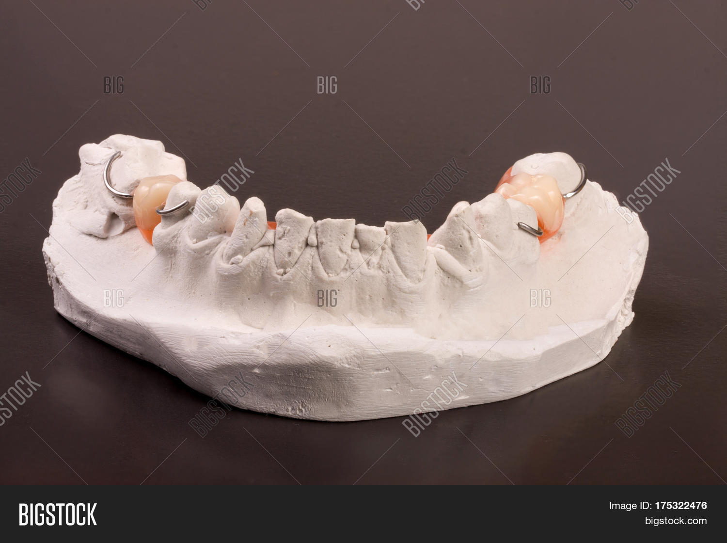 Plaster Cast Teeth Image & Photo (Free Trial) | Bigstock