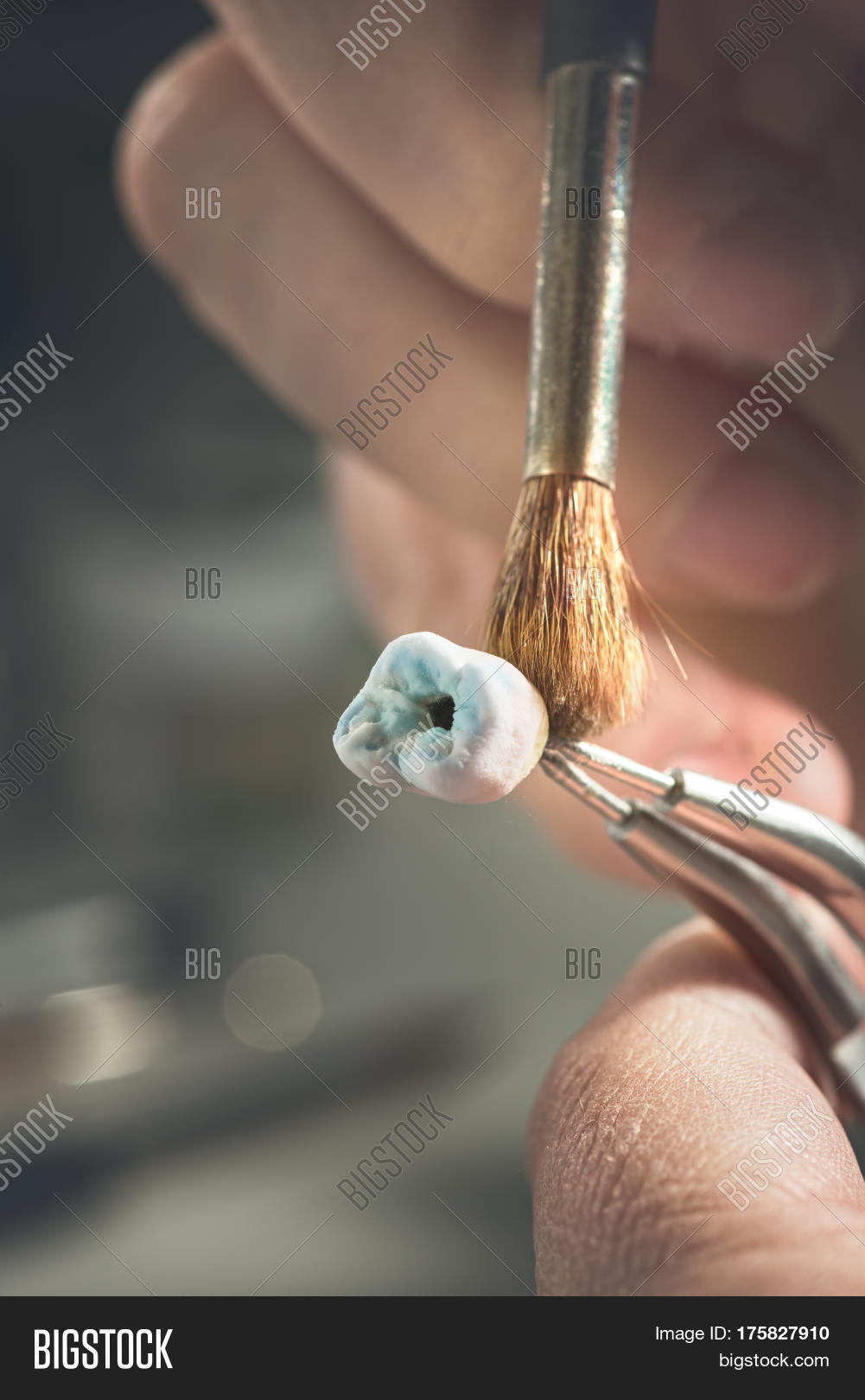 Dental Prosthesis Image & Photo (Free Trial) | Bigstock