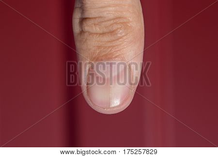 Forked Nail On Thumb. Image & Photo (Free Trial) | Bigstock