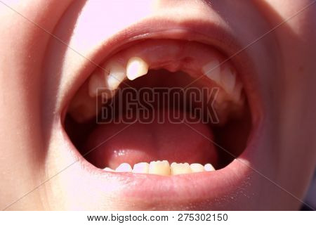 Mouth Without Teeth. Image & Photo (Free Trial) | Bigstock
