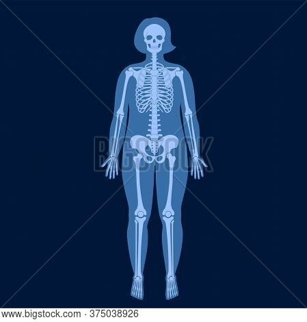 Human Woman Skeleton Vector & Photo (Free Trial) | Bigstock