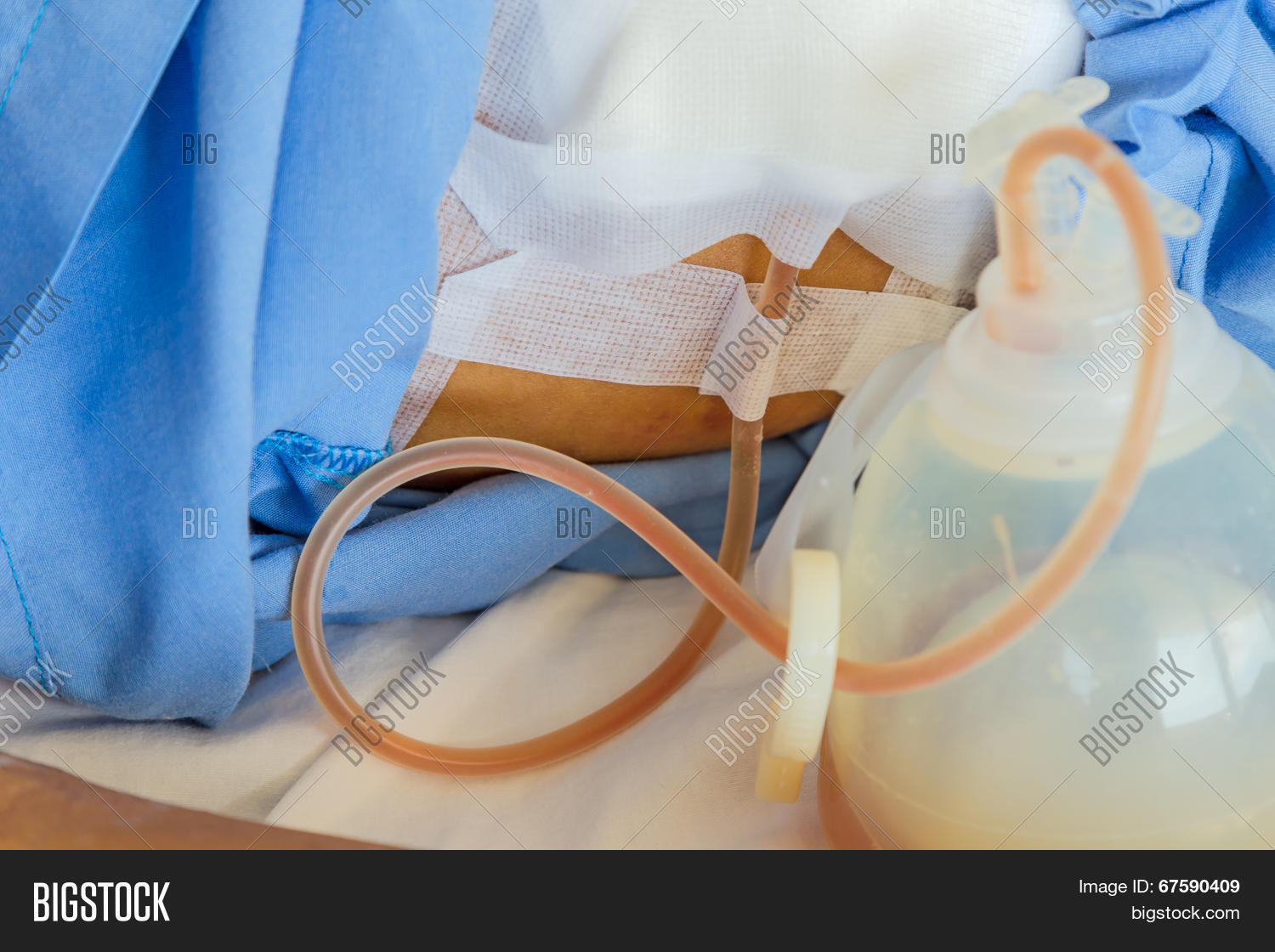 Blood Fluid Drain Image & Photo (Free Trial) | Bigstock