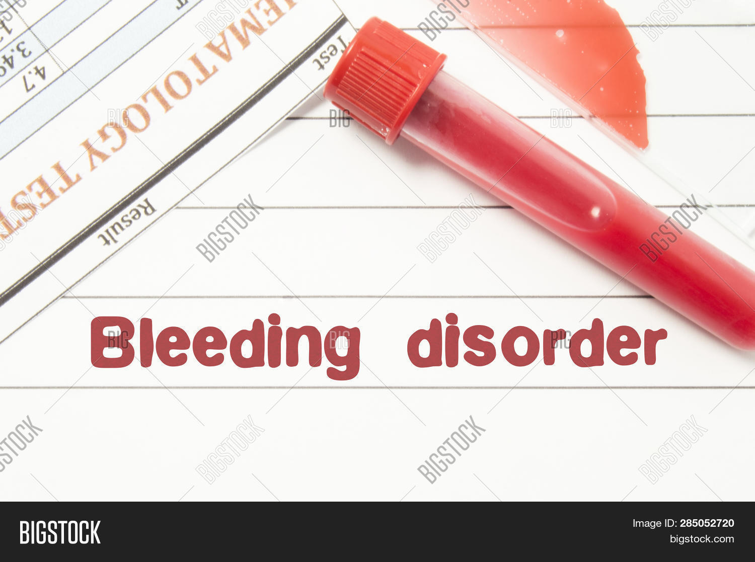 Diagnosis Bleeding Image & Photo (Free Trial) | Bigstock