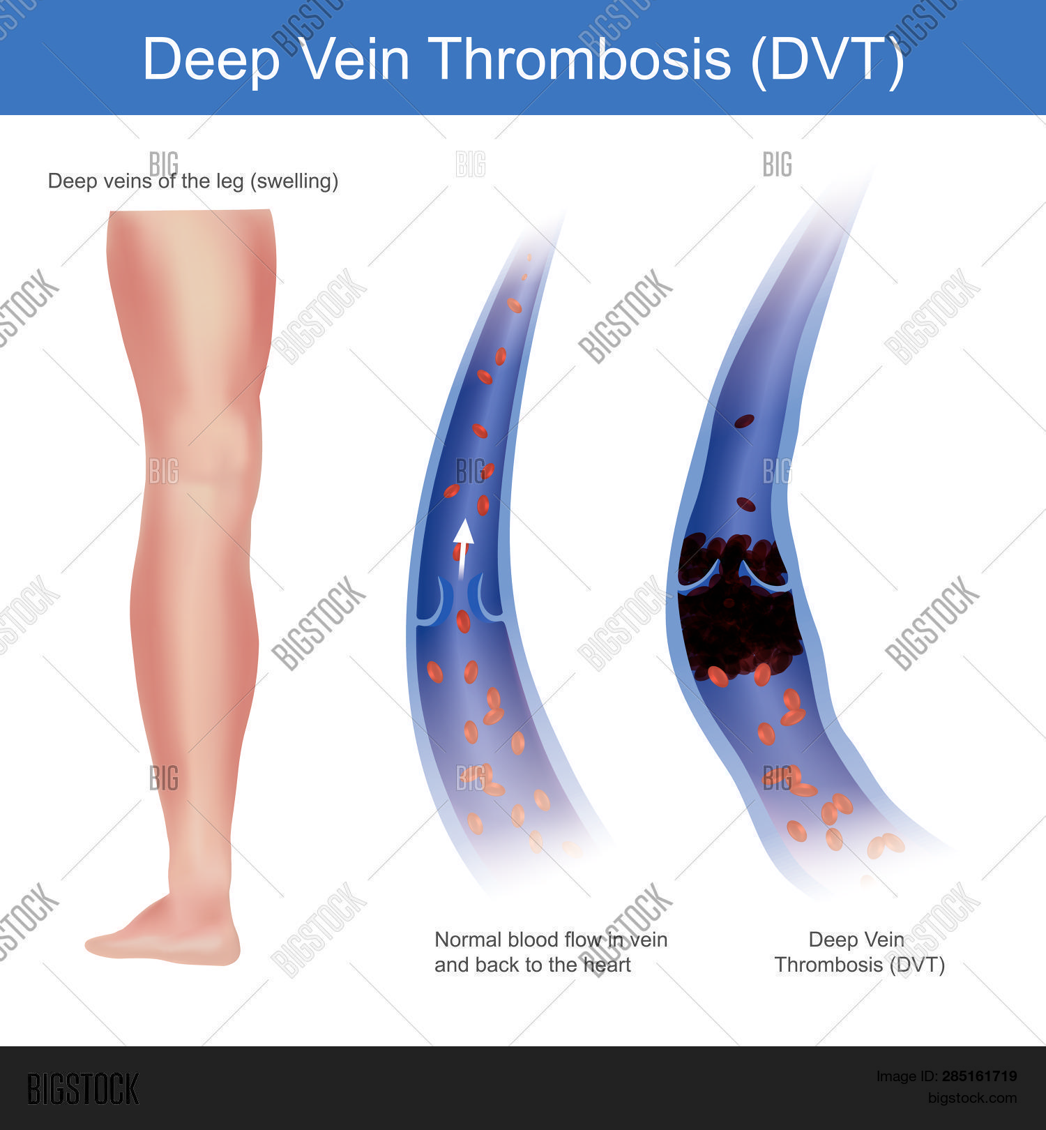 Normal Conditions Red Vector & Photo (Free Trial) | Bigstock
