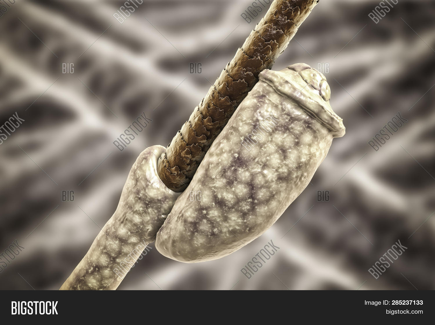 Human Head Louse Nit Image & Photo (Free Trial) | Bigstock