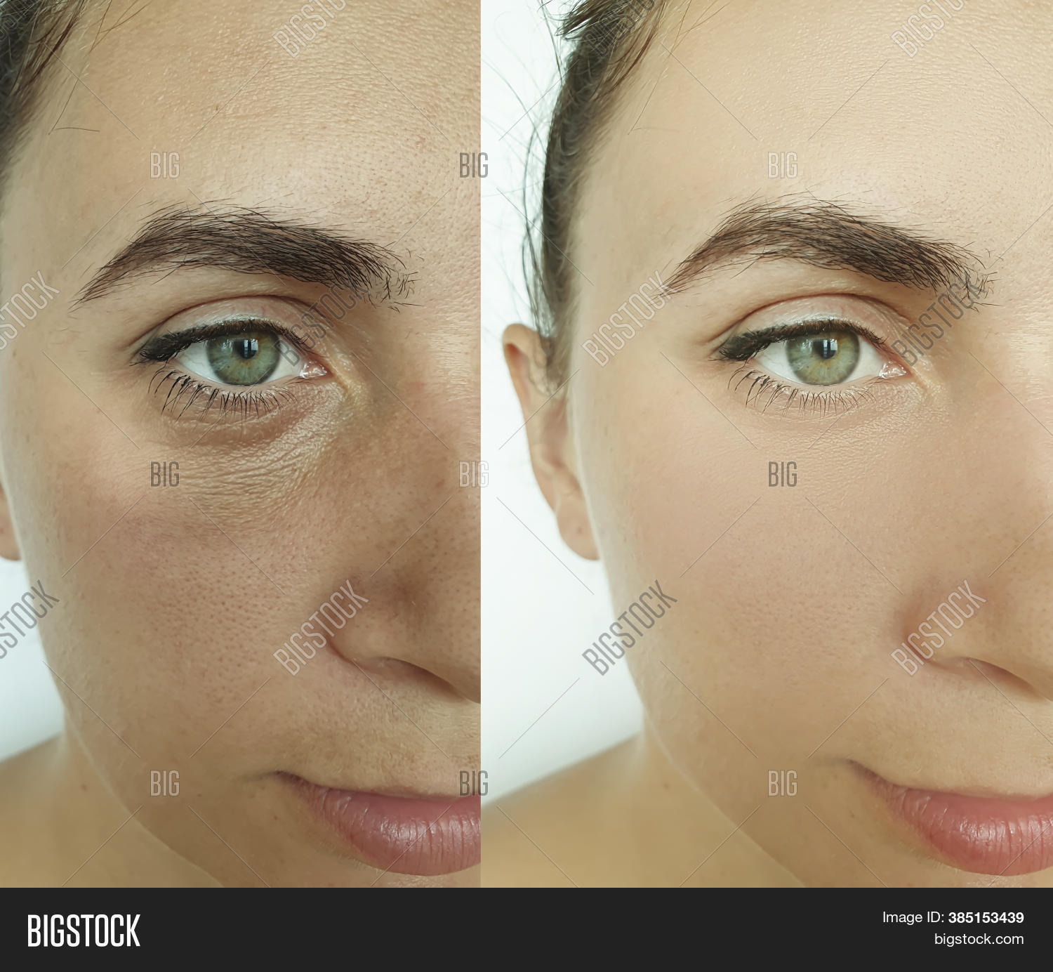 Woman Face Wrinkles Image & Photo (Free Trial) | Bigstock