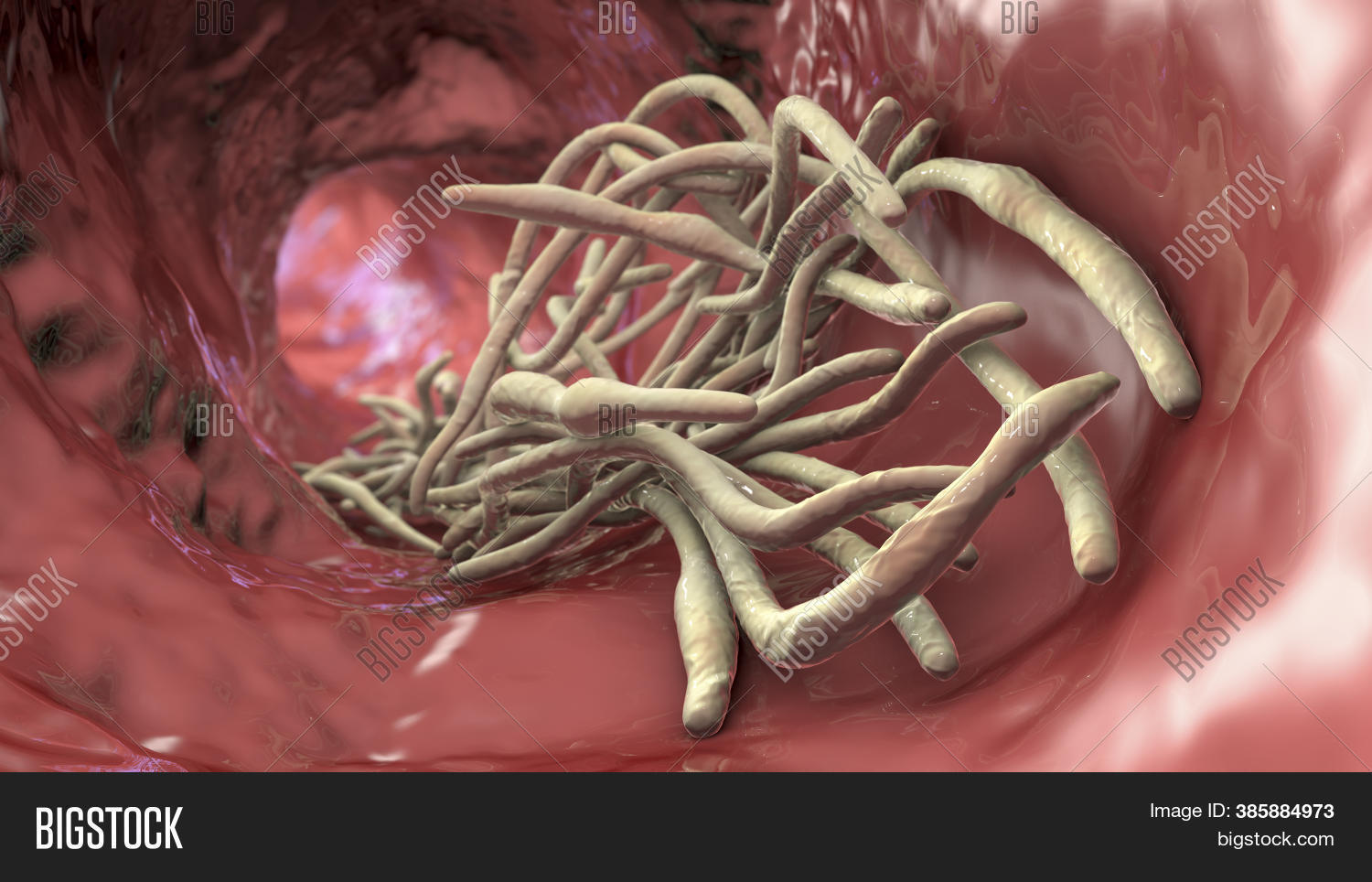 Parasitic Worms Lumen Image & Photo (Free Trial) | Bigstock