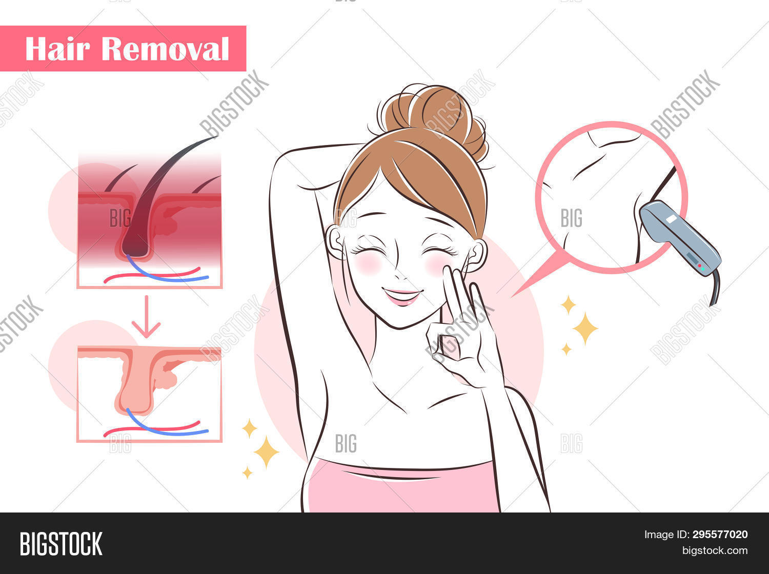 Cartoon Woman Remove Vector & Photo (Free Trial) | Bigstock