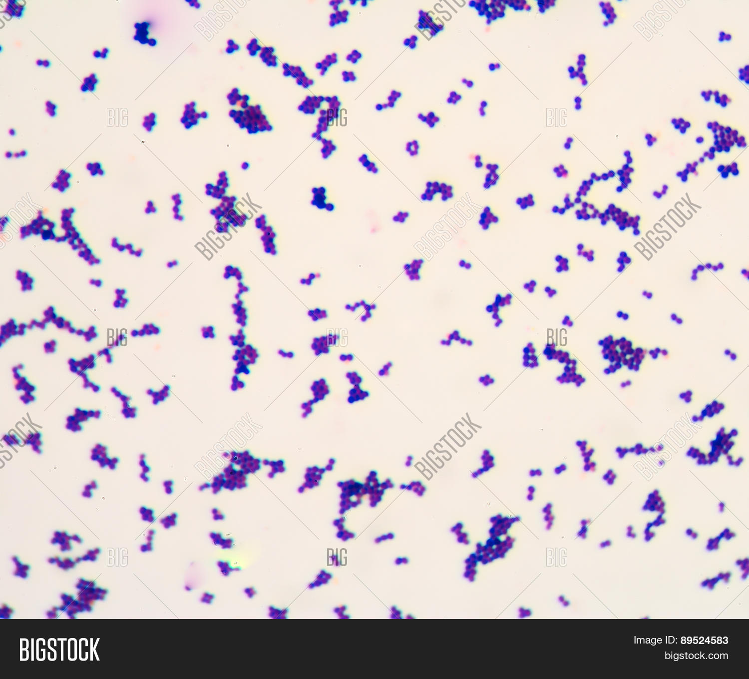 Imagen y foto Gram Staining, (prueba gratis) | Bigstock