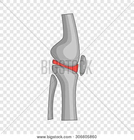 Total Knee Vector & Photo (Free Trial) | Bigstock