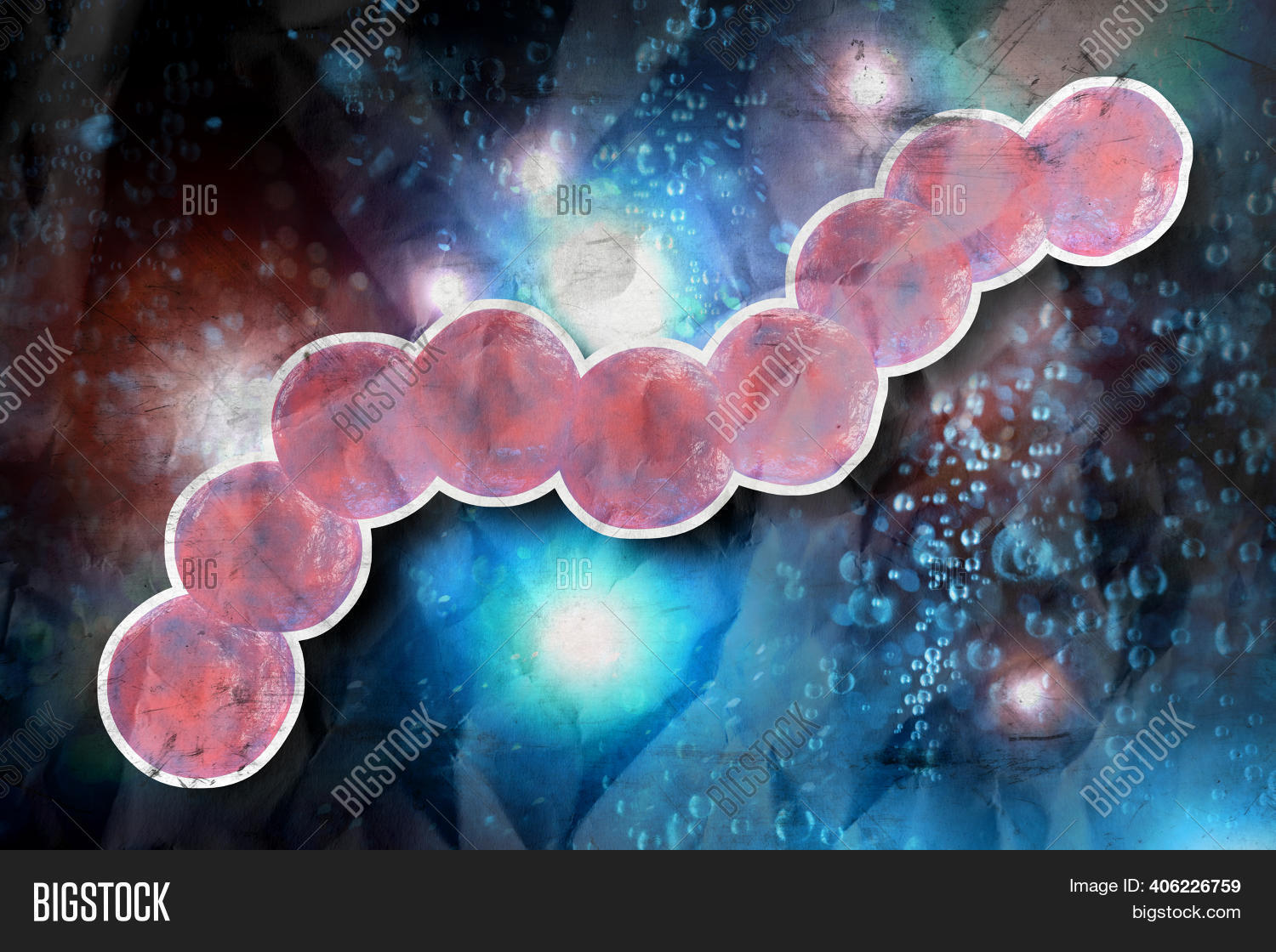 Strep Throat Known Image & Photo (Free Trial) | Bigstock