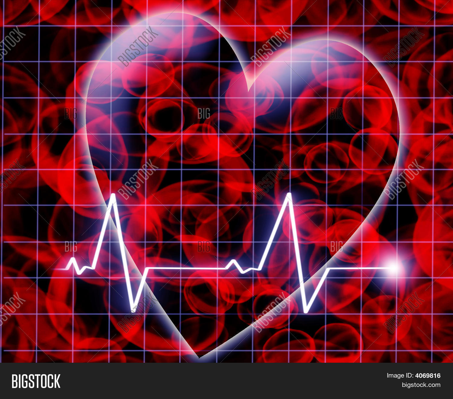 Heart Beat On Monitor Image & Photo (Free Trial) | Bigstock