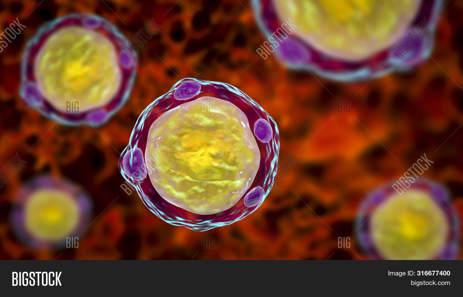 Blastocystis Hominis Image & Photo (Free Trial) | Bigstock