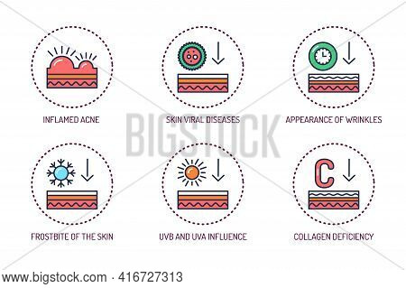 Effect On Skin Color Vector & Photo (Free Trial) | Bigstock