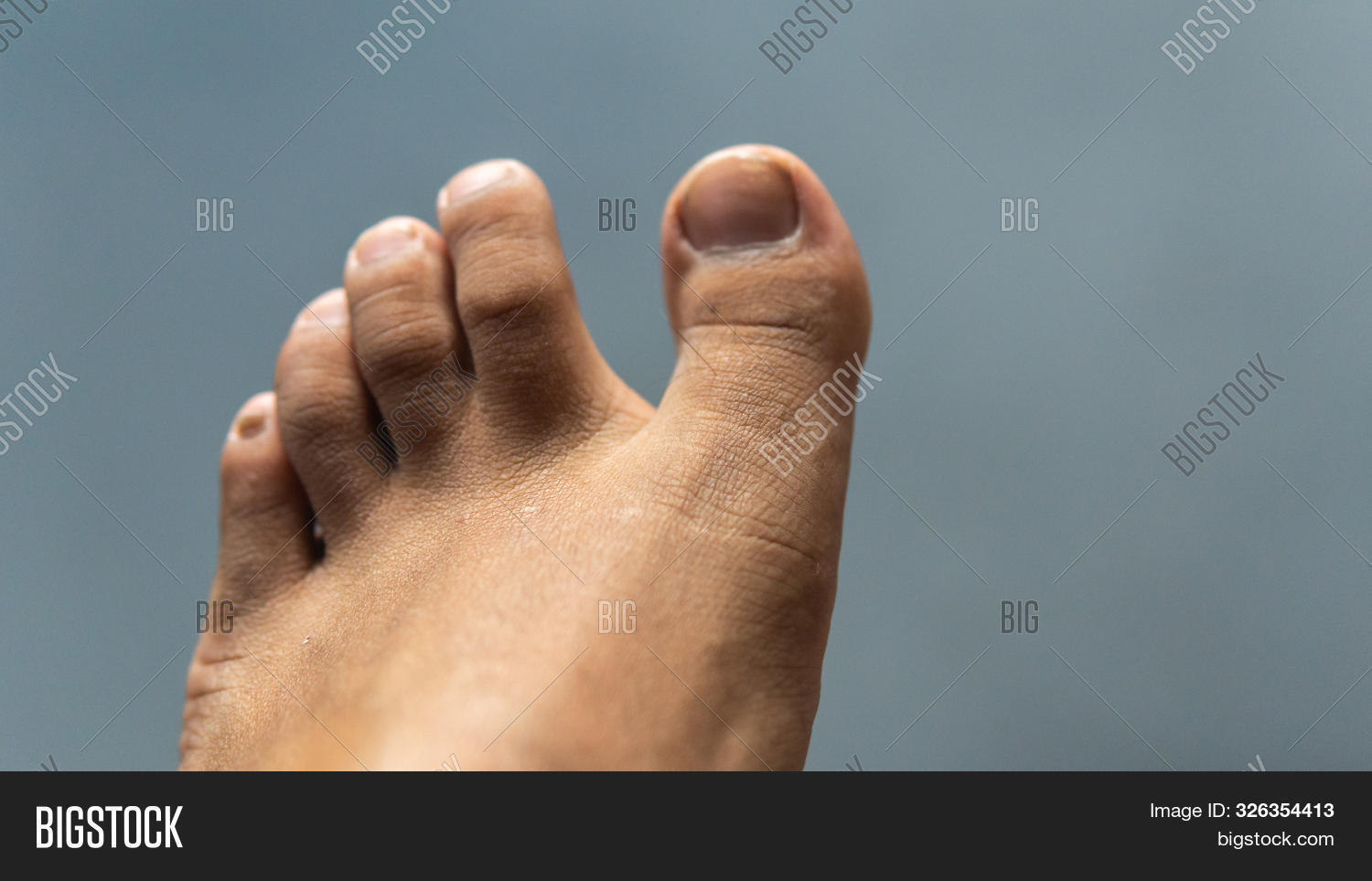 Close View Human Toes Image & Photo (Free Trial) | Bigstock