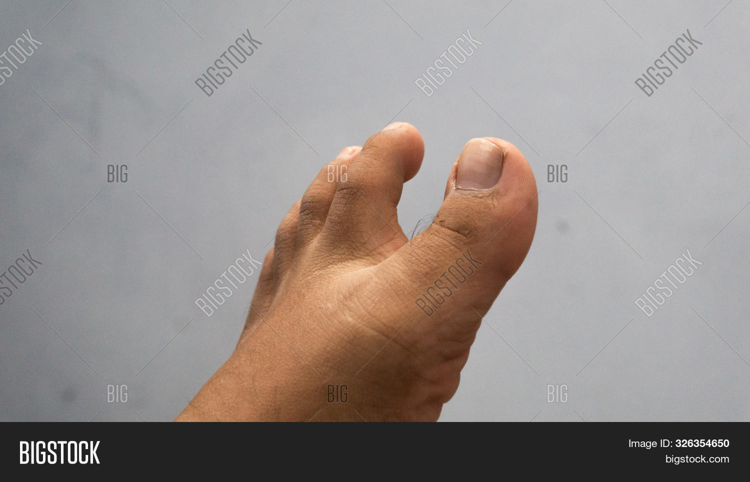 Close View Human Toes Image & Photo (Free Trial) | Bigstock