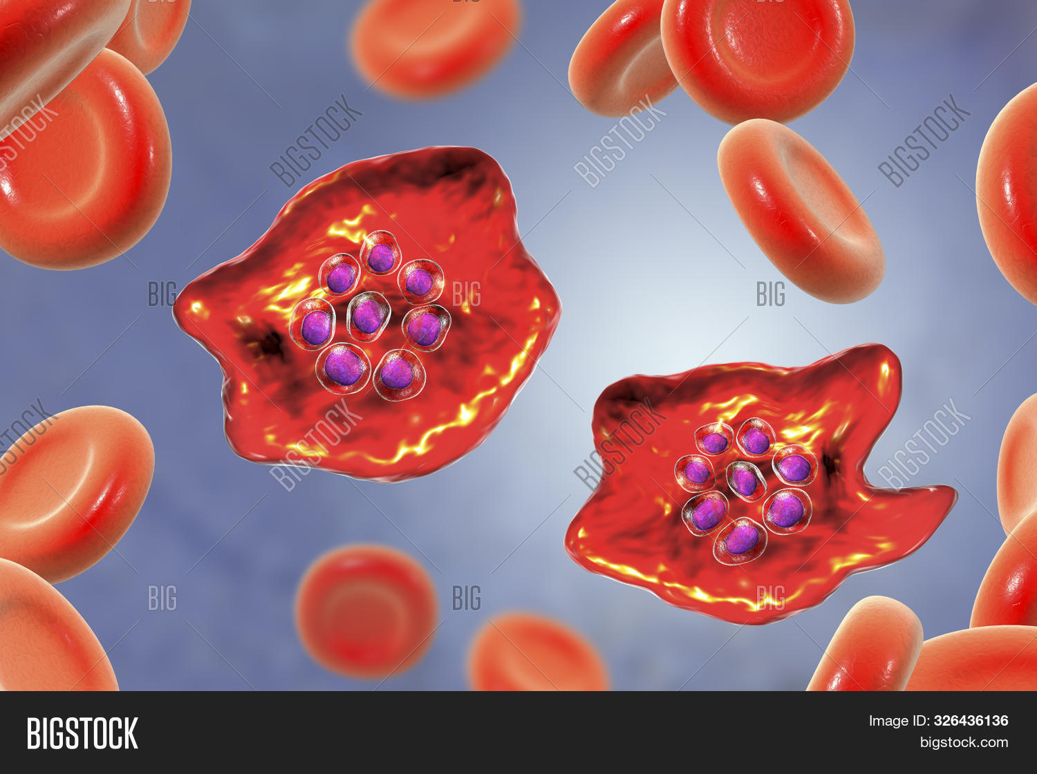 Malaria-infected Red Image & Photo (Free Trial) | Bigstock