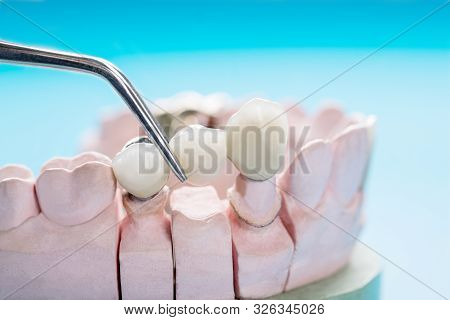 Closeup / Image & Photo (Free Trial) | Bigstock