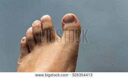 Close View Human Toes Image & Photo (Free Trial) | Bigstock