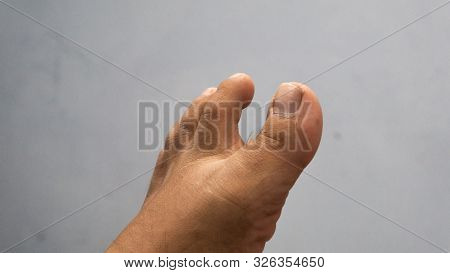 Close View Human Toes Image & Photo (Free Trial) | Bigstock