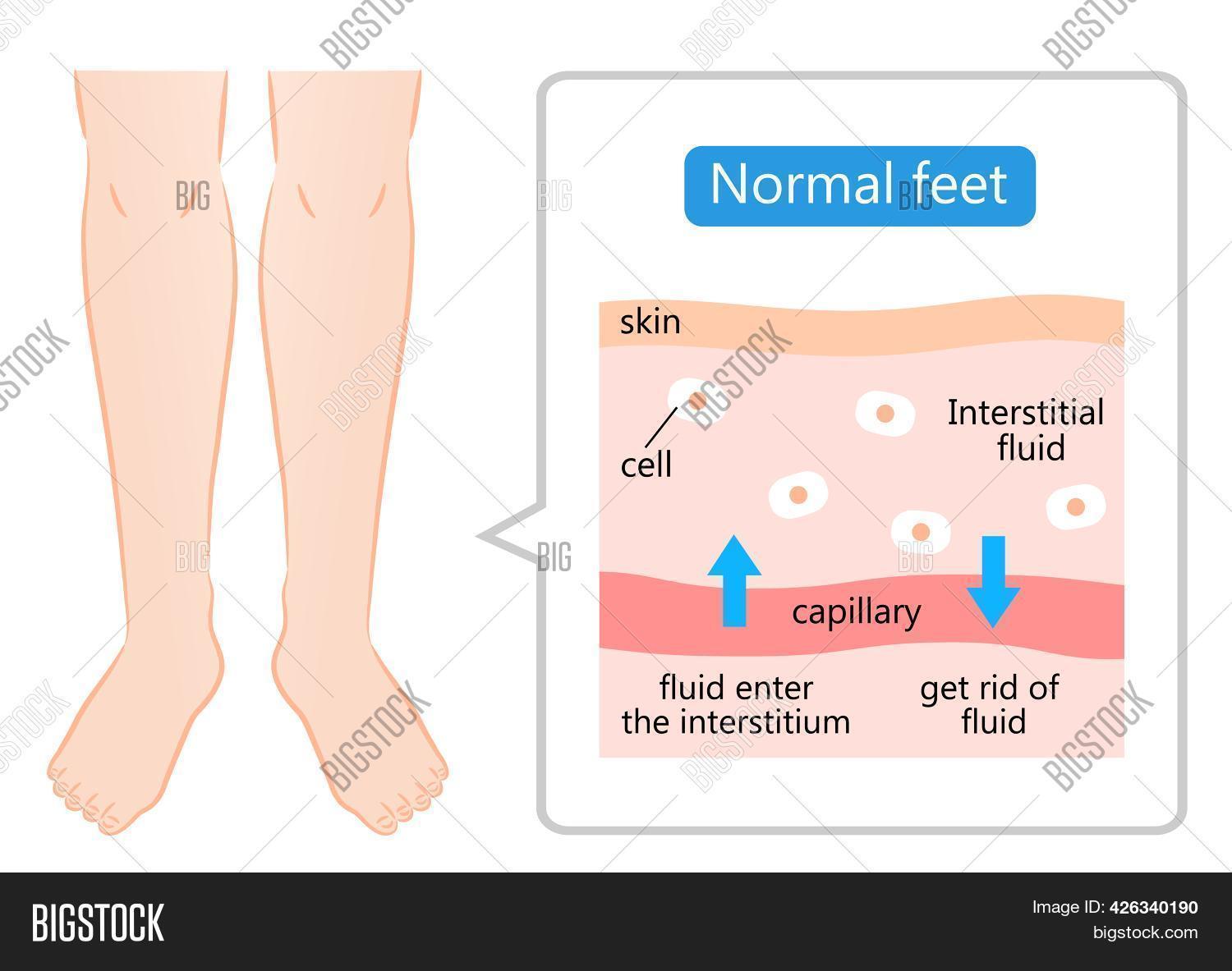 Normal Feet Skin Image & Photo (Free Trial) | Bigstock