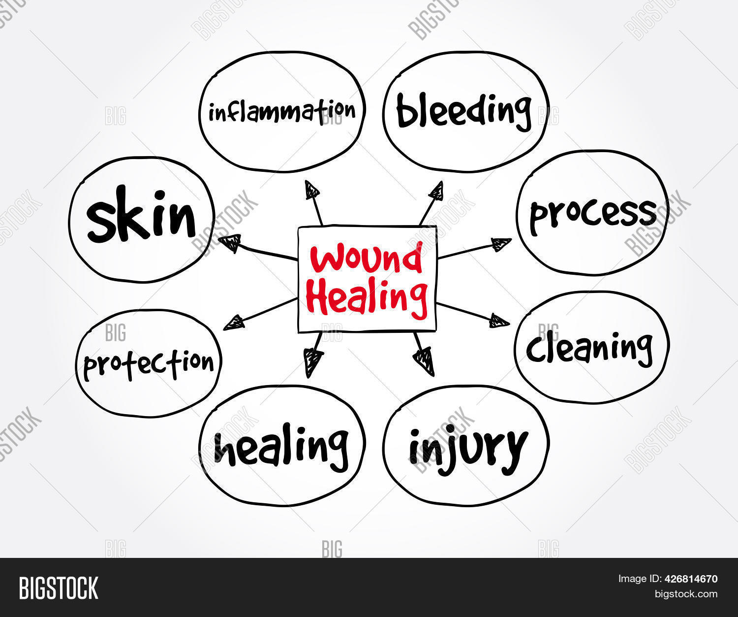 Wound Healing Mind Map Image & Photo (Free Trial) | Bigstock