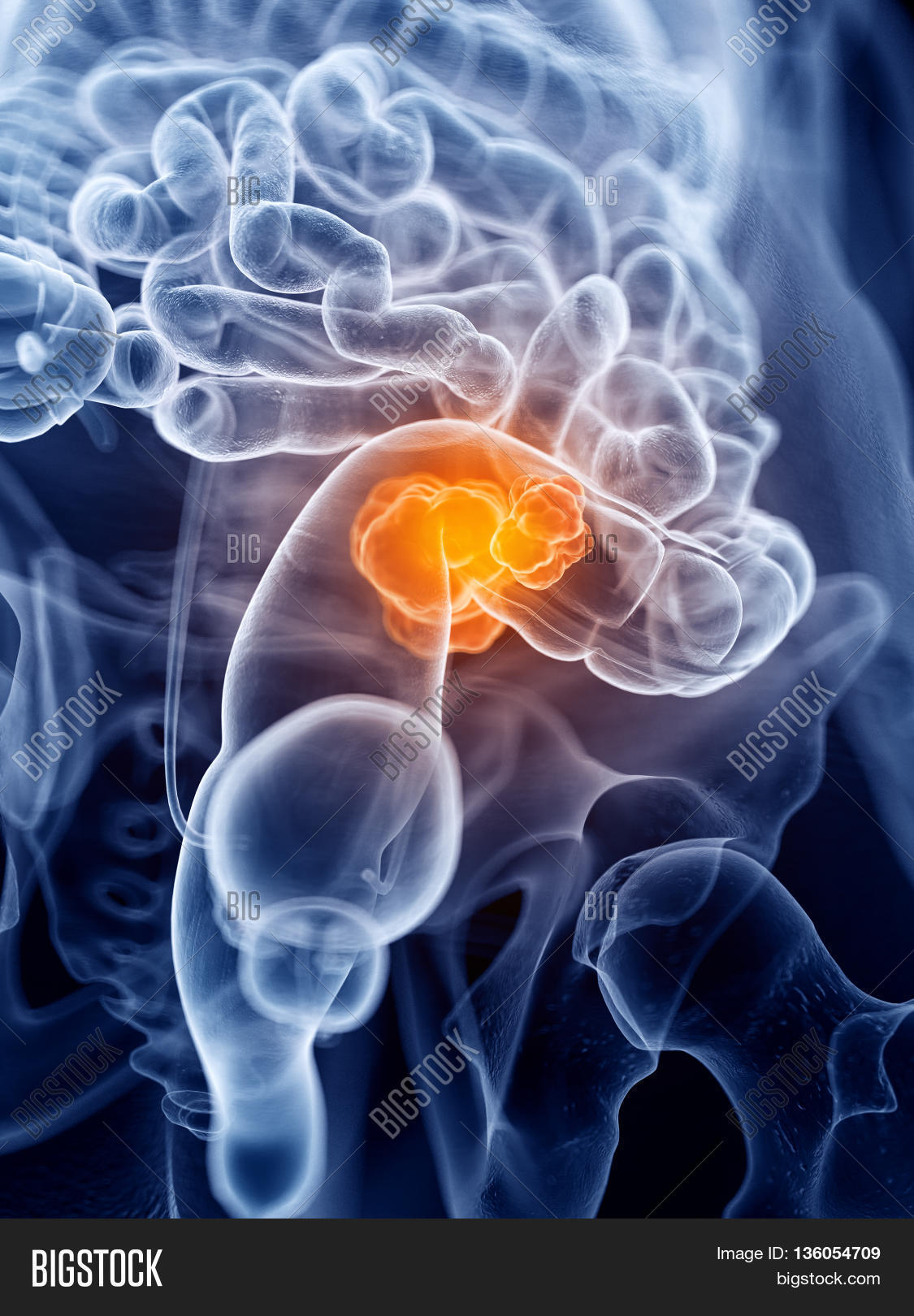 3d Rendered Medically Image And Photo Free Trial Bigstock