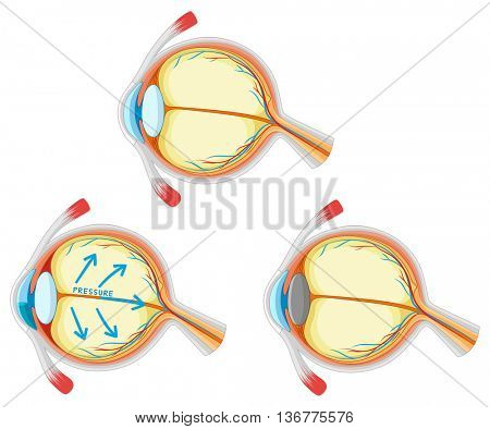 Diagram Showing Eyes Vector & Photo (Free Trial) | Bigstock