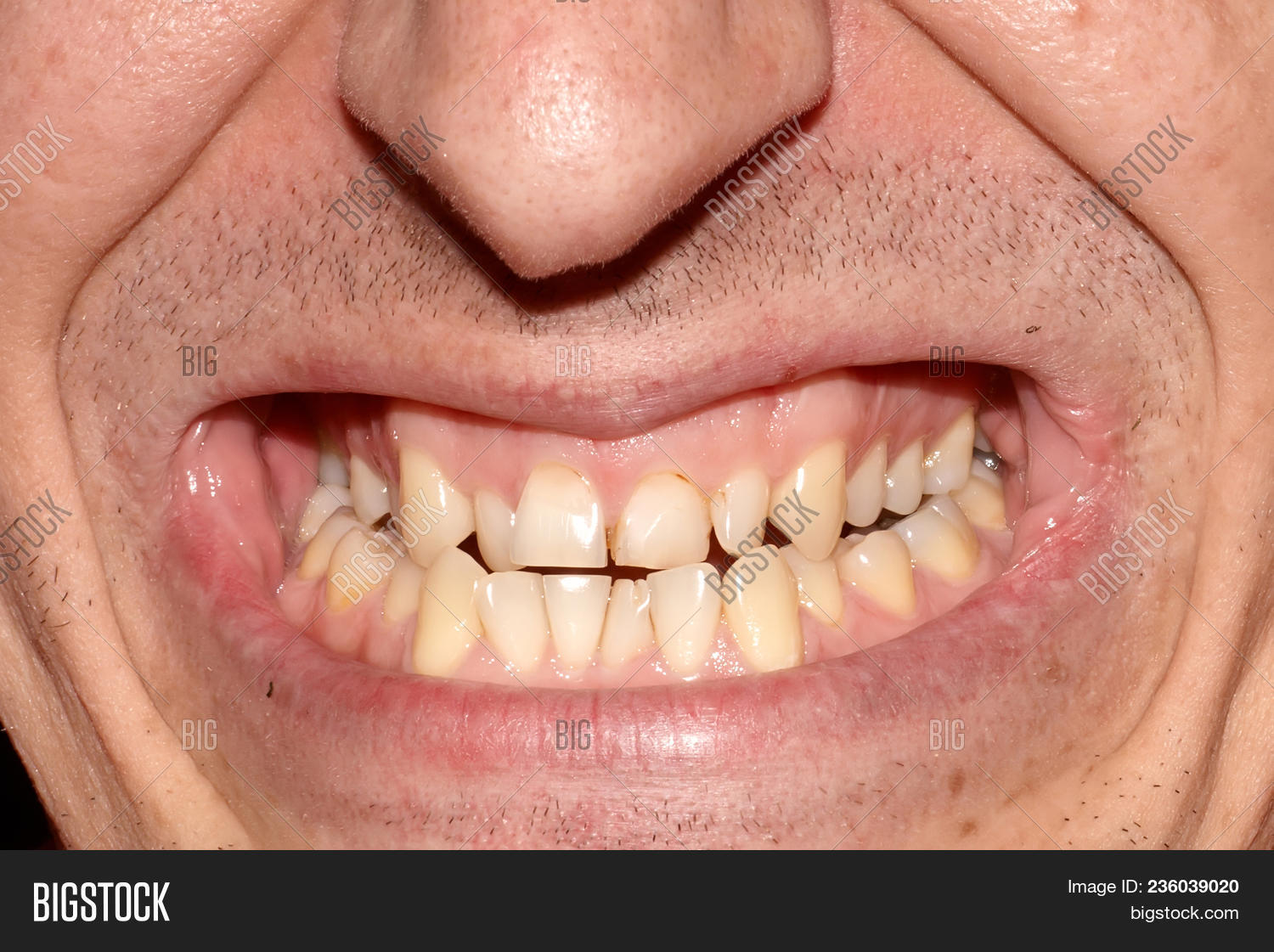 Mouth Man Crooked Image & Photo (Free Trial) | Bigstock
