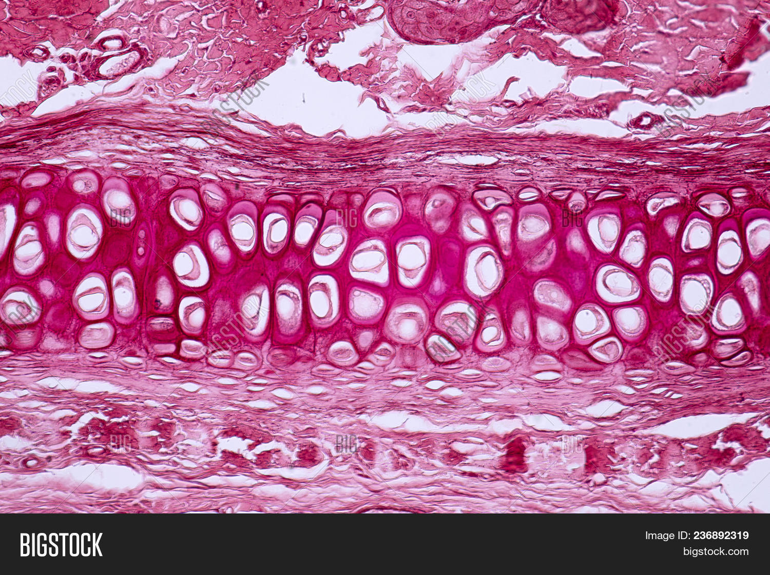 Cross Section Human Image & Photo (Free Trial) | Bigstock
